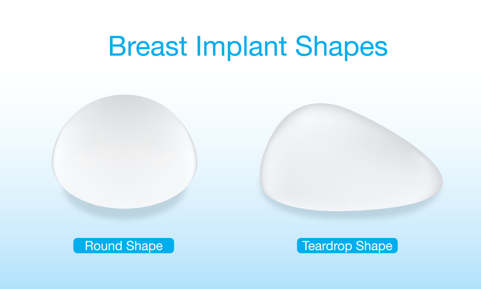 Breast Implant Brands and Types Available in San Diego