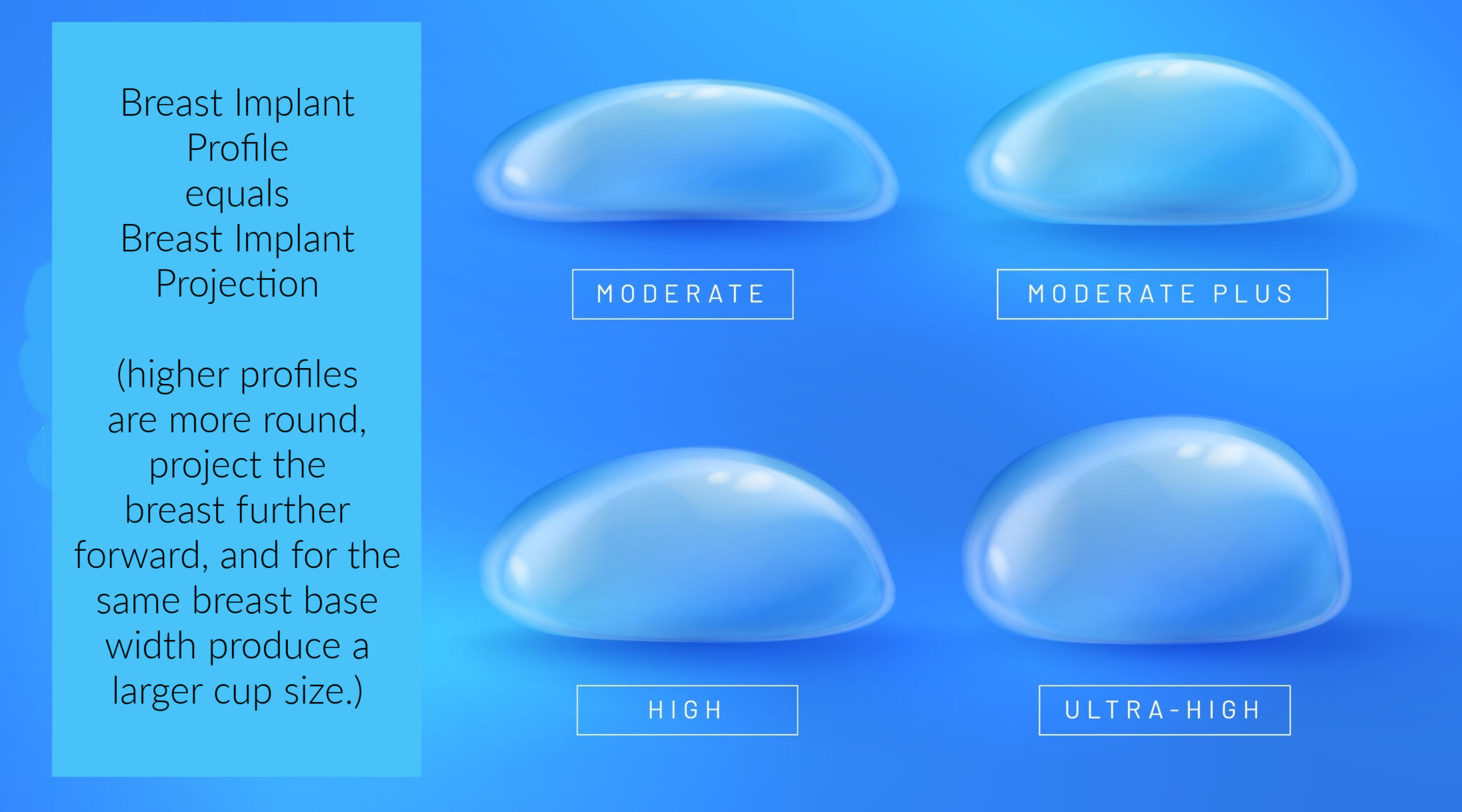 Ultra High Profile Implants- Feel Beautiful San Diego